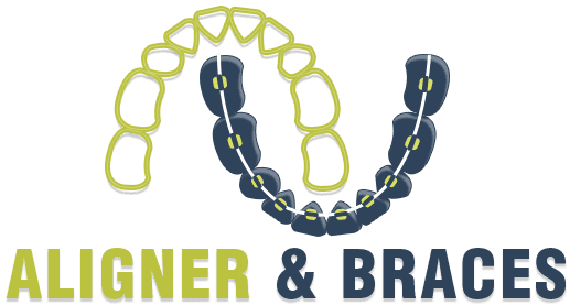 Aligner & Braces - aligner-and-braces-logo.png - ICOLINK